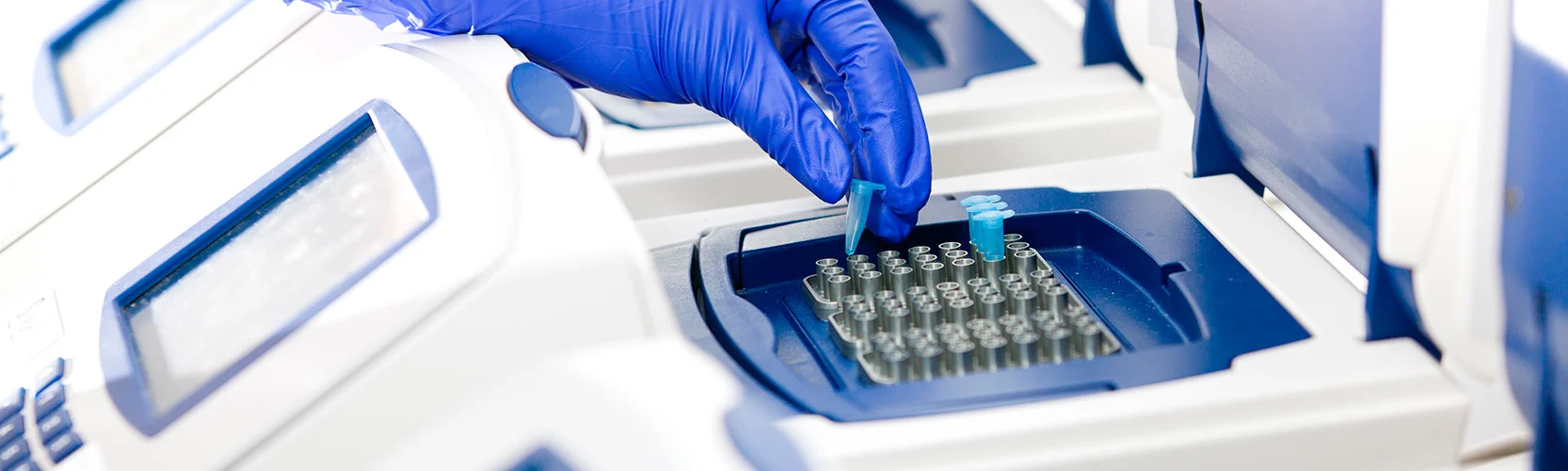 Examen de ADN para identificación: ¿Qué es? – Examen de ADN